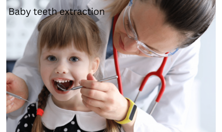 Why visit a dentist for baby teeth extraction? - Long Falls Dentistry