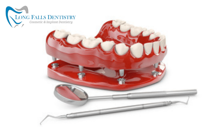 The Ultimate Solution for Tightening Loose Denture Screws